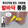 발바닥이 아픈이유가 염증 족저근막염 원인 및 자가치료 방법 네이버 블로그